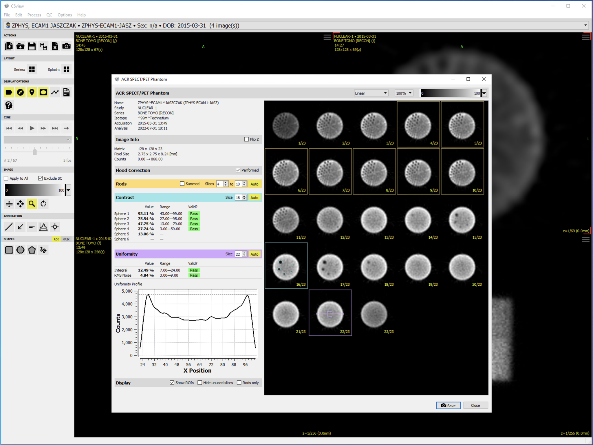applications - QUAD Cedars-Sinai
